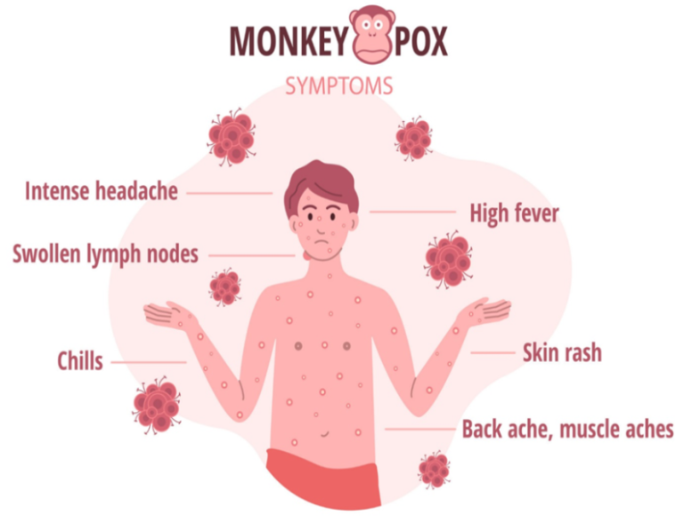 Monkeypox: The World's Latest Health Crisis - Pratisandhi